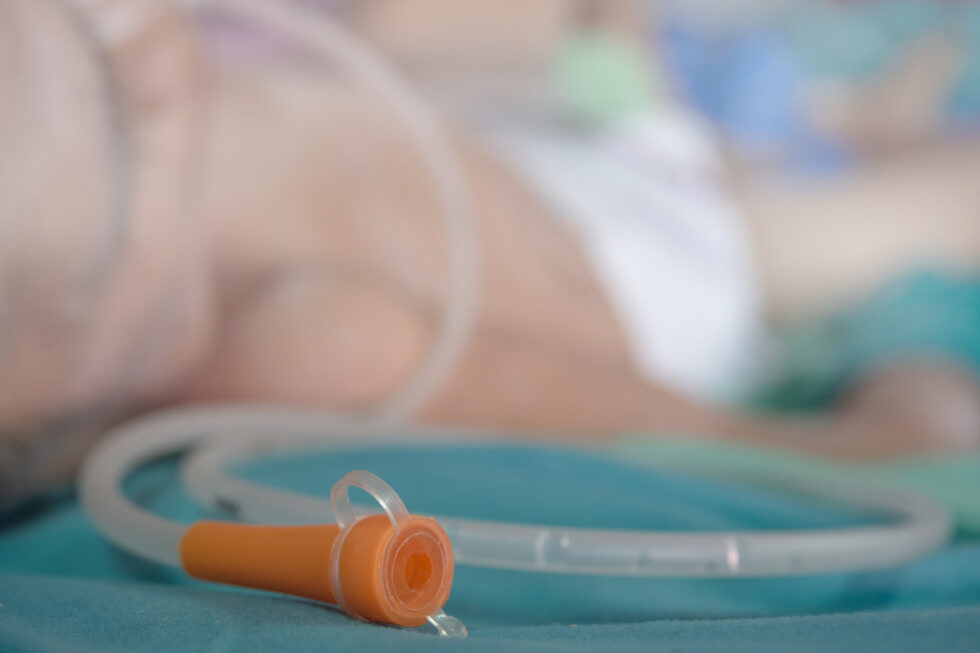 What is PEG feeding? - Independence Australia